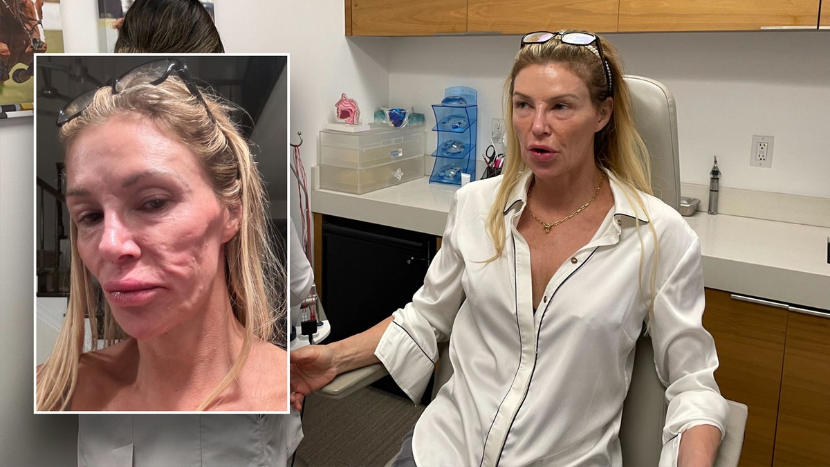 Former reality star Brandi Glanville spent over $113,000 treating a ...